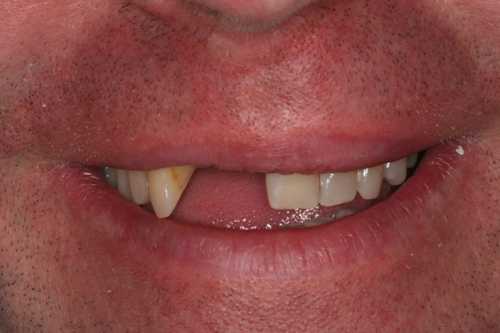 Clinical tips: smile line assessment - Irish Dentistry