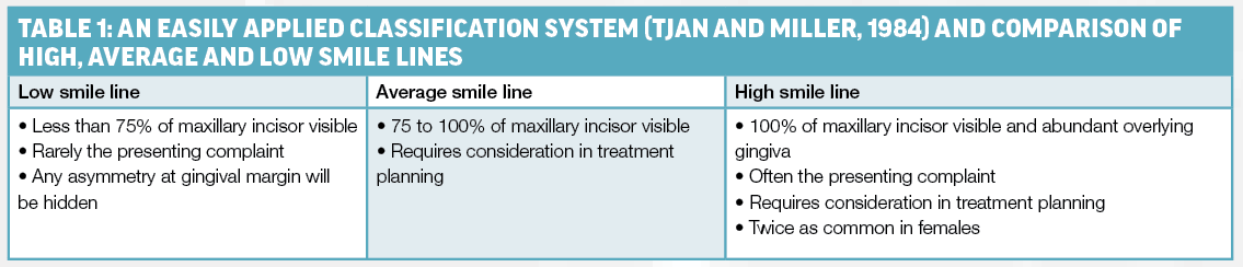 Clinical tips: smile line assessment - Irish Dentistry